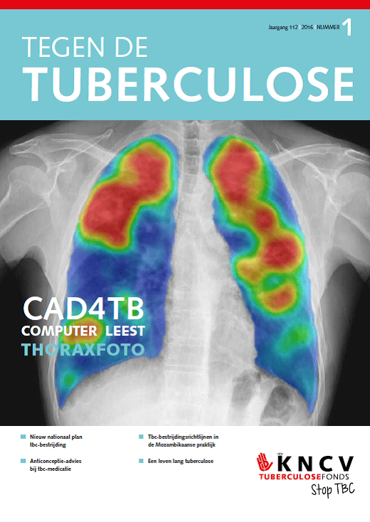 KNCV – E-DETECT TB